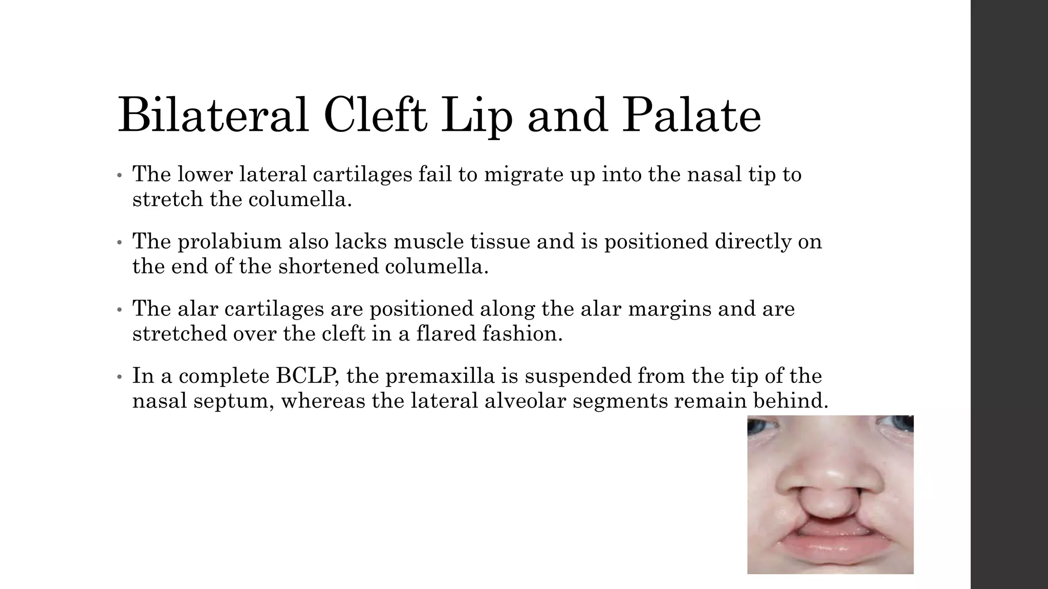 Naso alveolar molding treatment protocol in patients with cleft | PPTX
