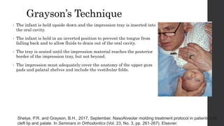 Naso alveolar molding treatment protocol in patients with cleft | PPTX
