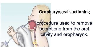 naso and oro.pptxhjgjhjkhlknkljlkklbbhjghj | PPT