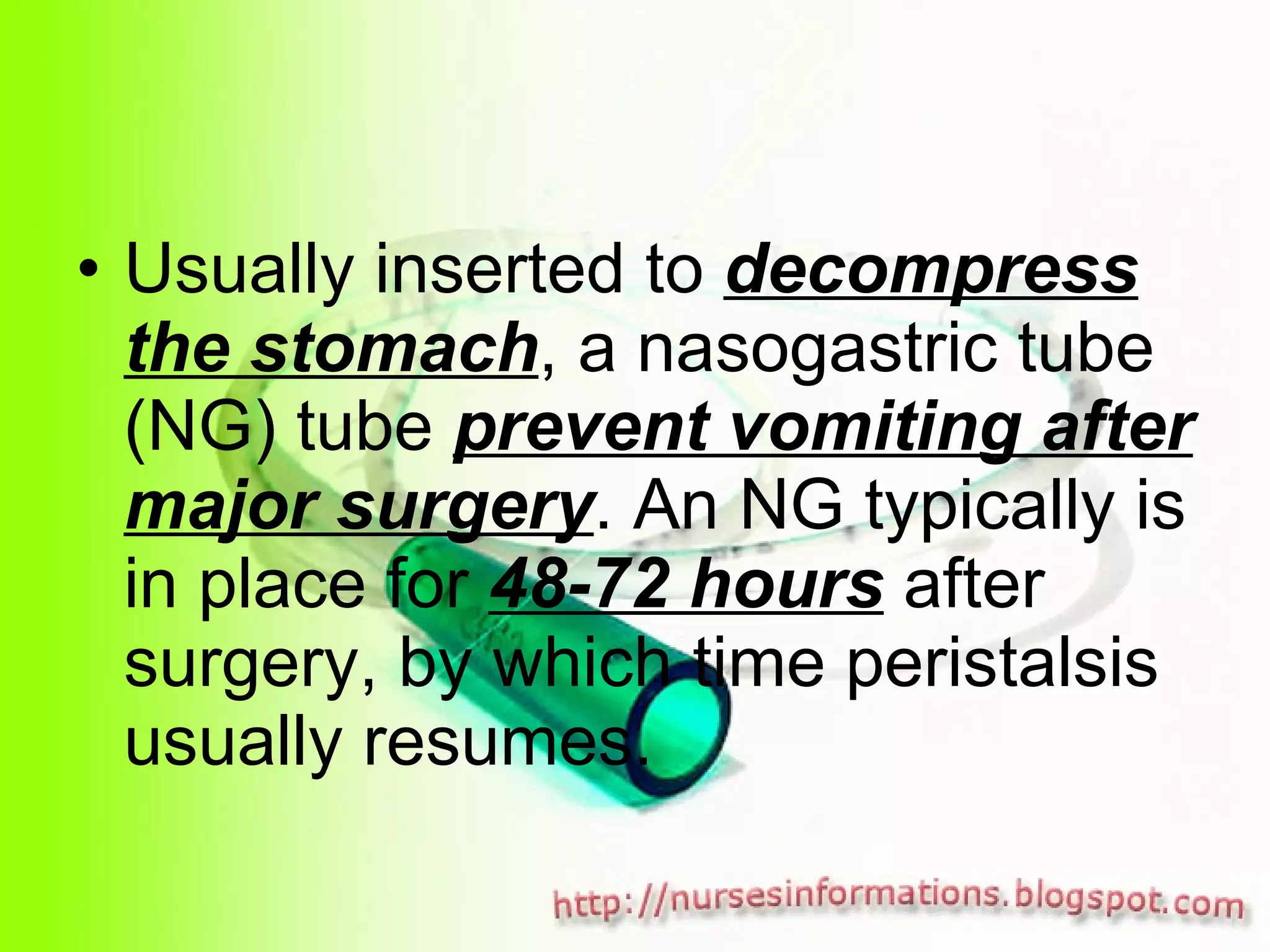 Nasogastric Tube (NGT) insertion and removal | PPS