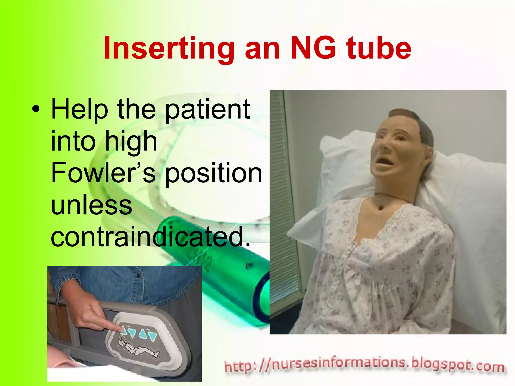 Nasogastric Tube (NGT) insertion and removal | PPS