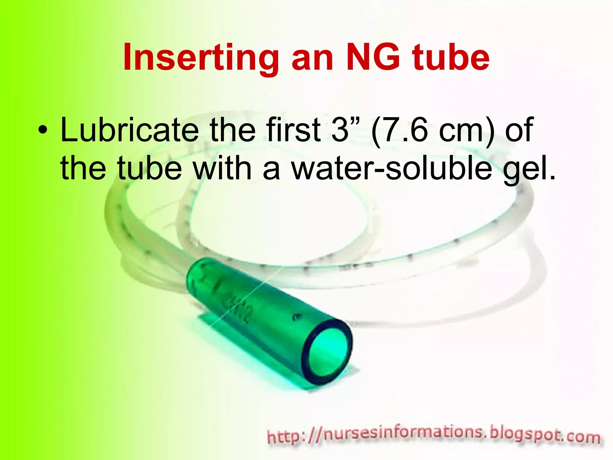 Nasogastric Tube (NGT) insertion and removal | PPS