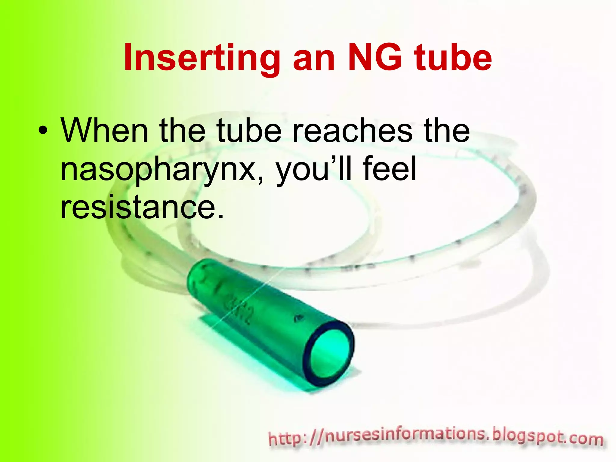 Nasogastric Tube (NGT) insertion and removal | PPS