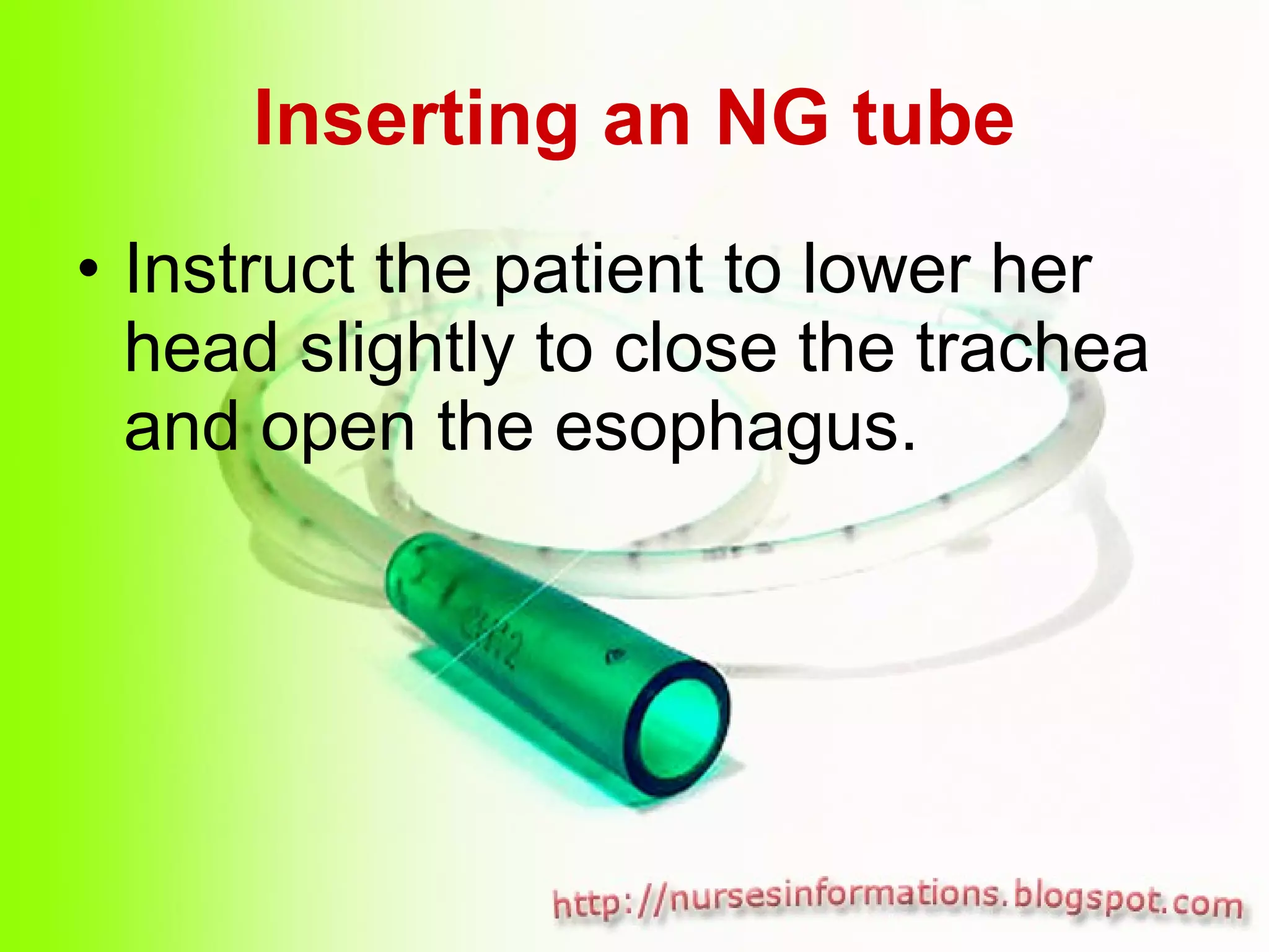 Nasogastric Tube (NGT) insertion and removal | PPS