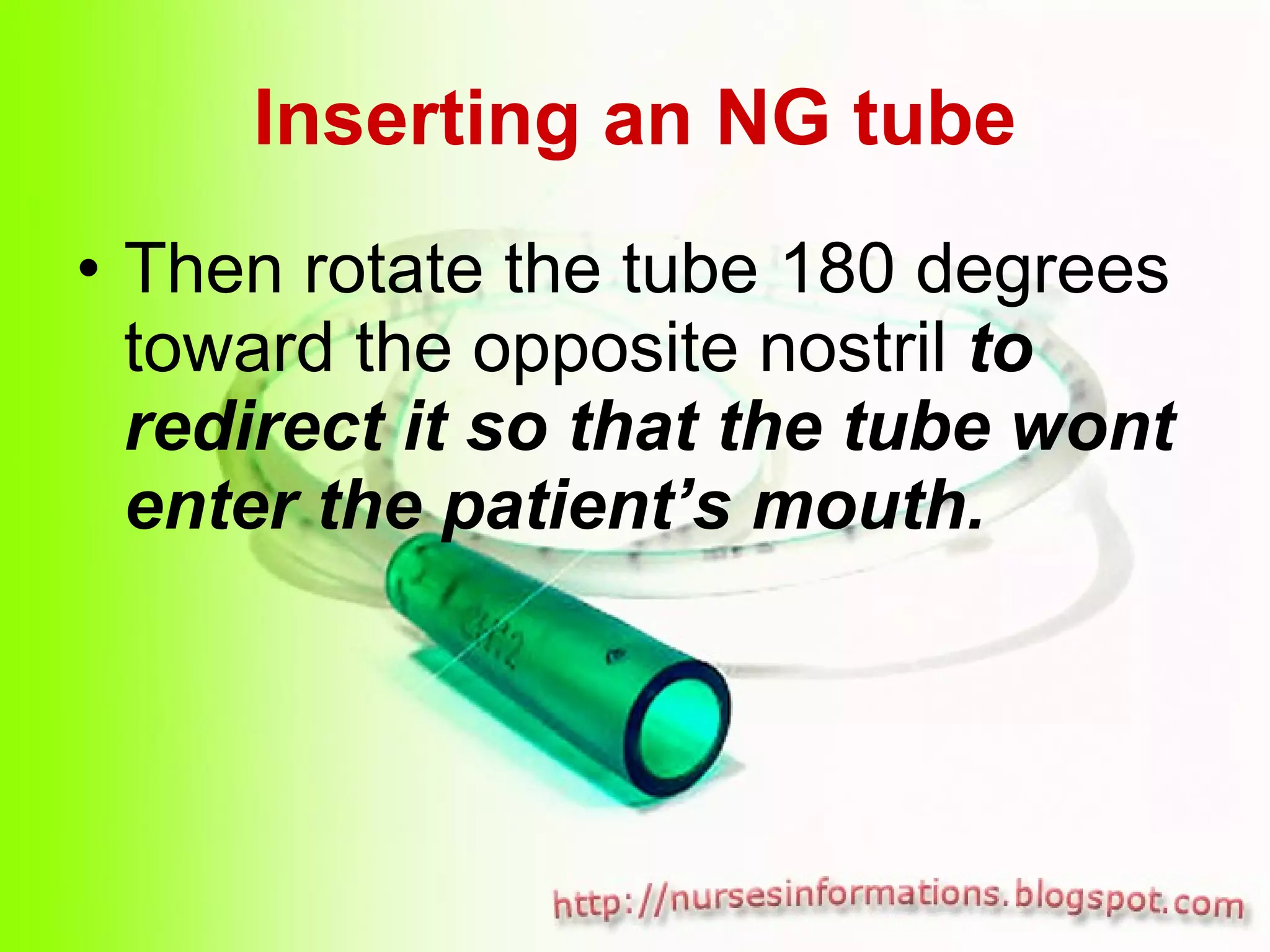 Nasogastric Tube (NGT) insertion and removal | PPS