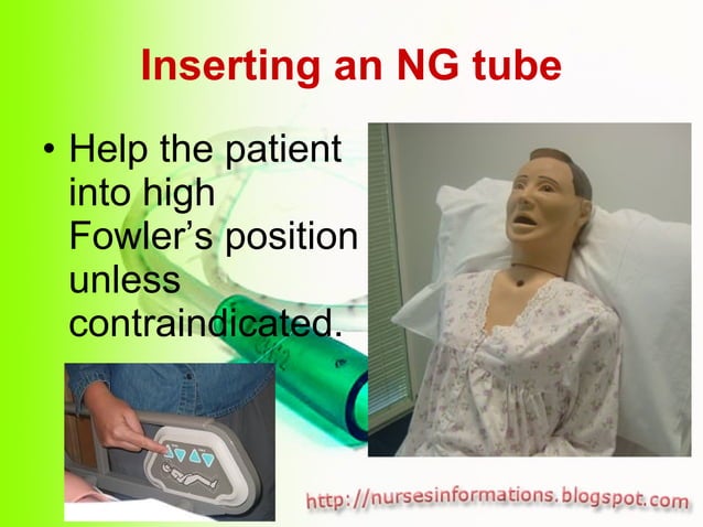 Nasogastric Tube (NGT) insertion and removal | PPS