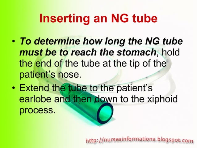 Nasogastric Tube (NGT) insertion and removal | PPS