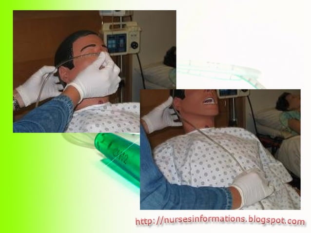 Nasogastric Tube (NGT) insertion and removal | PPS