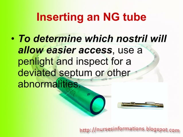 Nasogastric Tube (NGT) insertion and removal | PPS