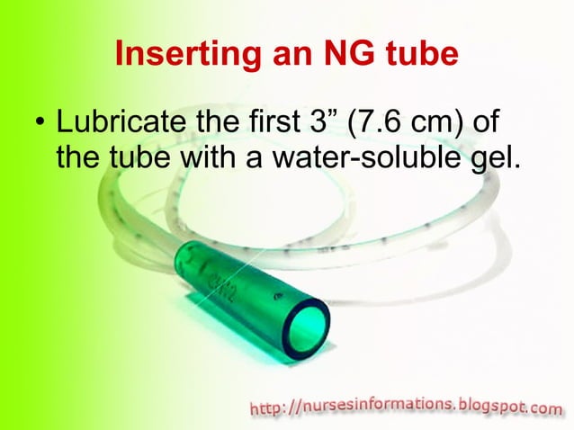 Nasogastric Tube (NGT) insertion and removal | PPS