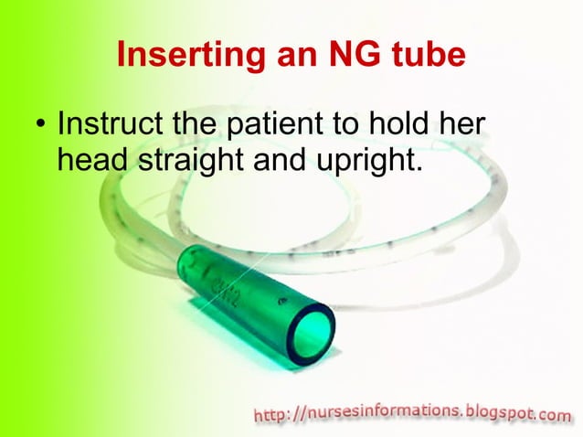Nasogastric Tube (NGT) insertion and removal | PPS