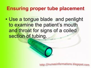 Nasogastric Tube (NGT) insertion and removal | PPS