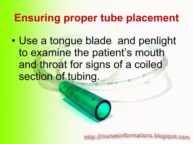 Nasogastric Tube (NGT) insertion and removal | PPS