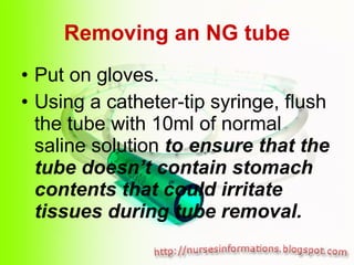 Nasogastric Tube (NGT) insertion and removal | PPS