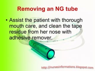 Nasogastric Tube (NGT) insertion and removal | PPS