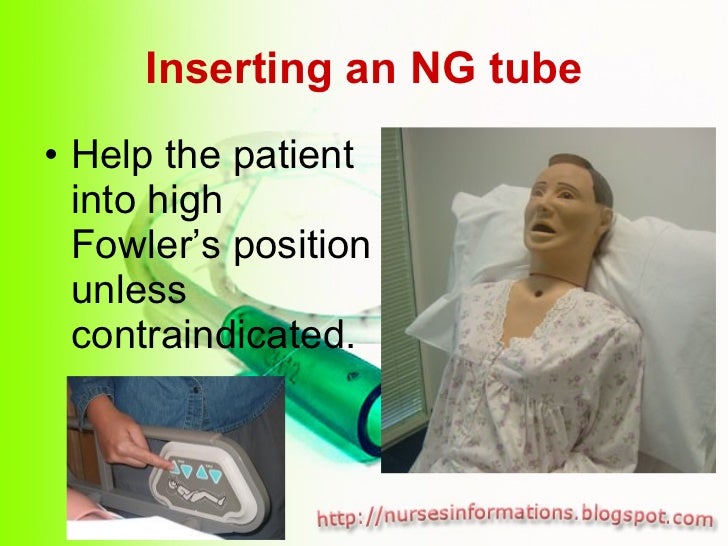 Nasogastric Tube (NGT) insertion and removal
