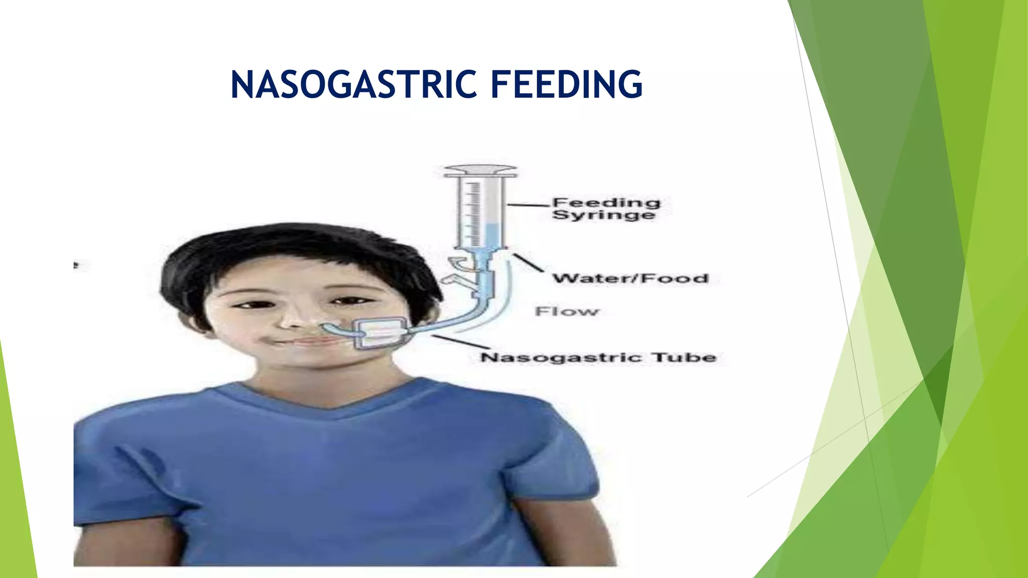 nasogastric feeding (33).pptx