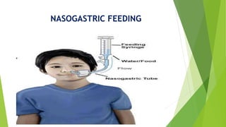 nasogastric feeding (33).pptx