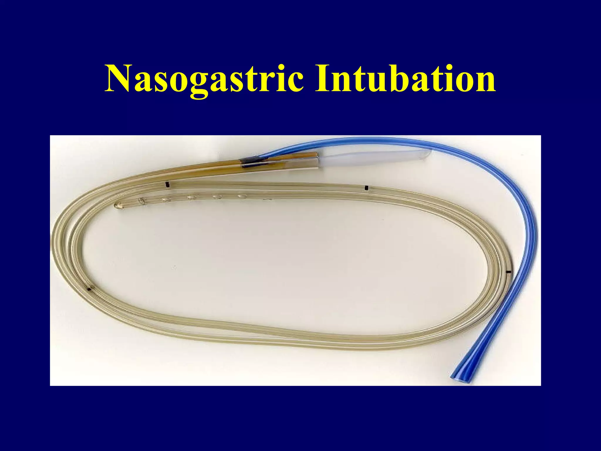 Nasogastric intubation | PPT
