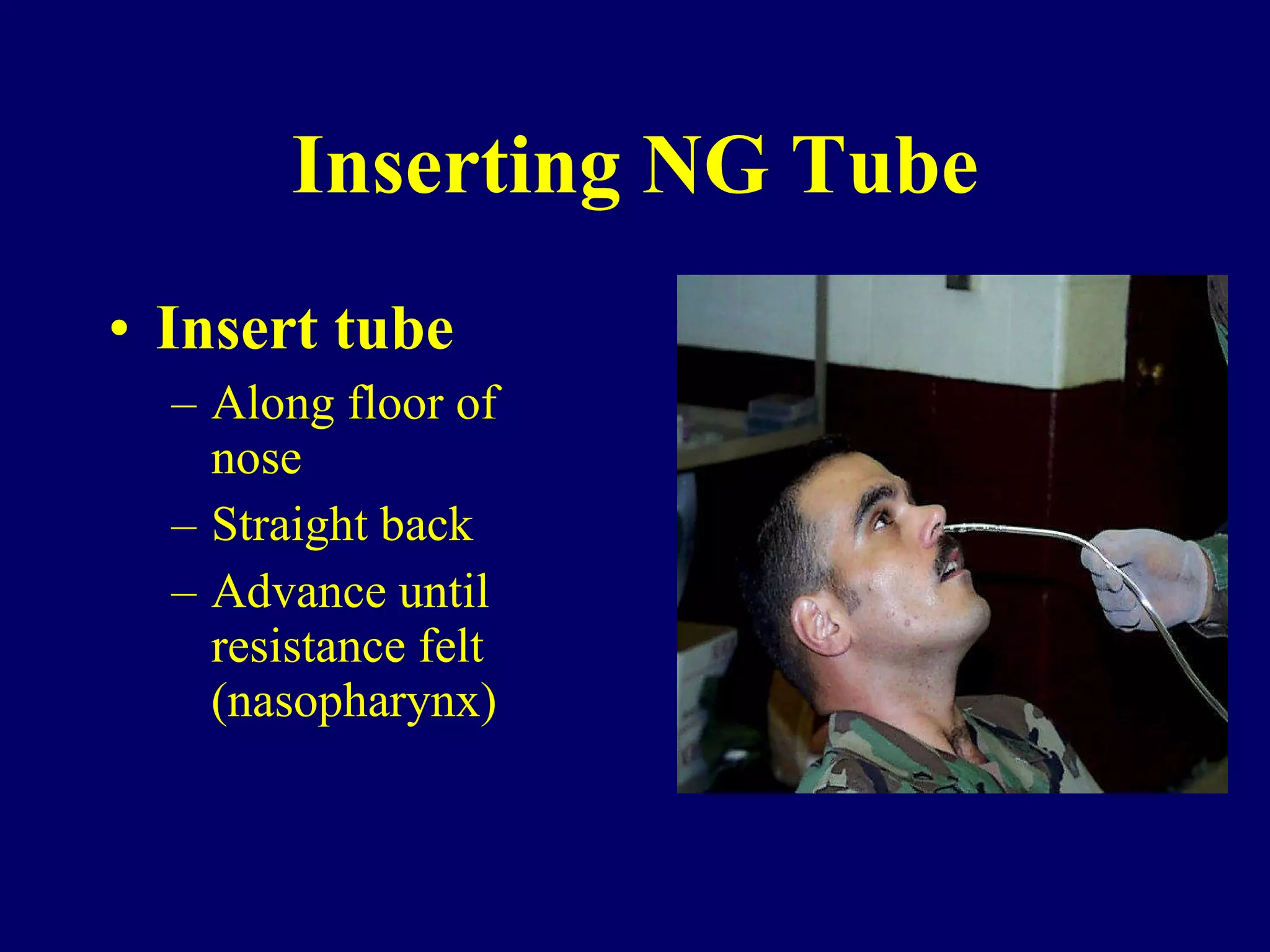 Nasogastric intubation | PPT