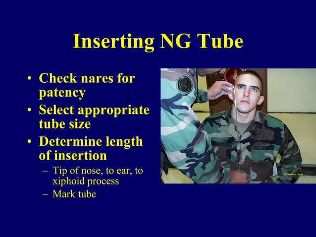 Nasogastric intubation | PPT