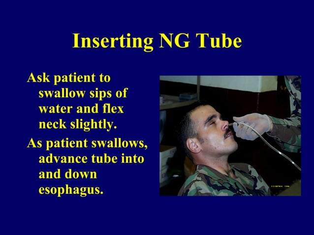 Nasogastric intubation | PPT