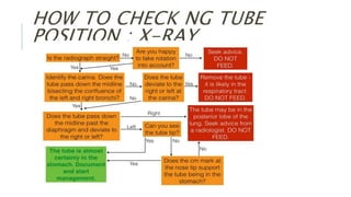 Nasogastric Tube.pptx