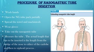 nasogastric tube insertion and nasogastric tube feeding | PPTX