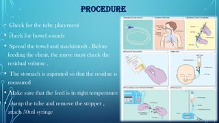 nasogastric tube insertion and nasogastric tube feeding | PPTX