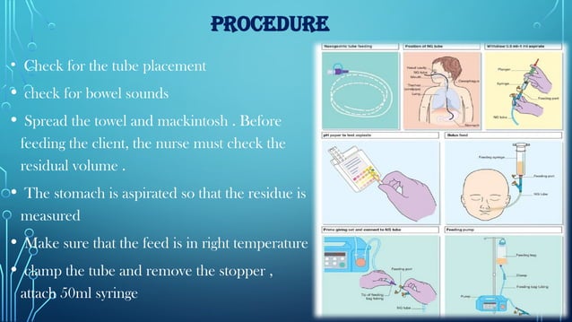 nasogastric tube insertion and nasogastric tube feeding | PPTX