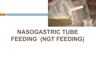Nasogastric tube insertion and feeding | PPTX