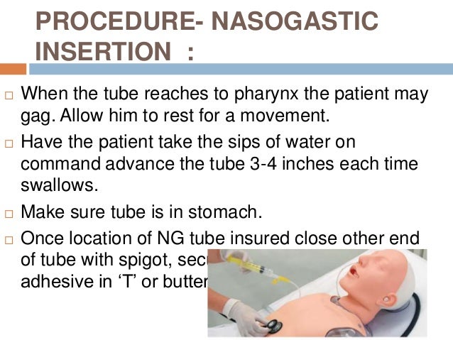 Nasogastric tube insertion and feeding