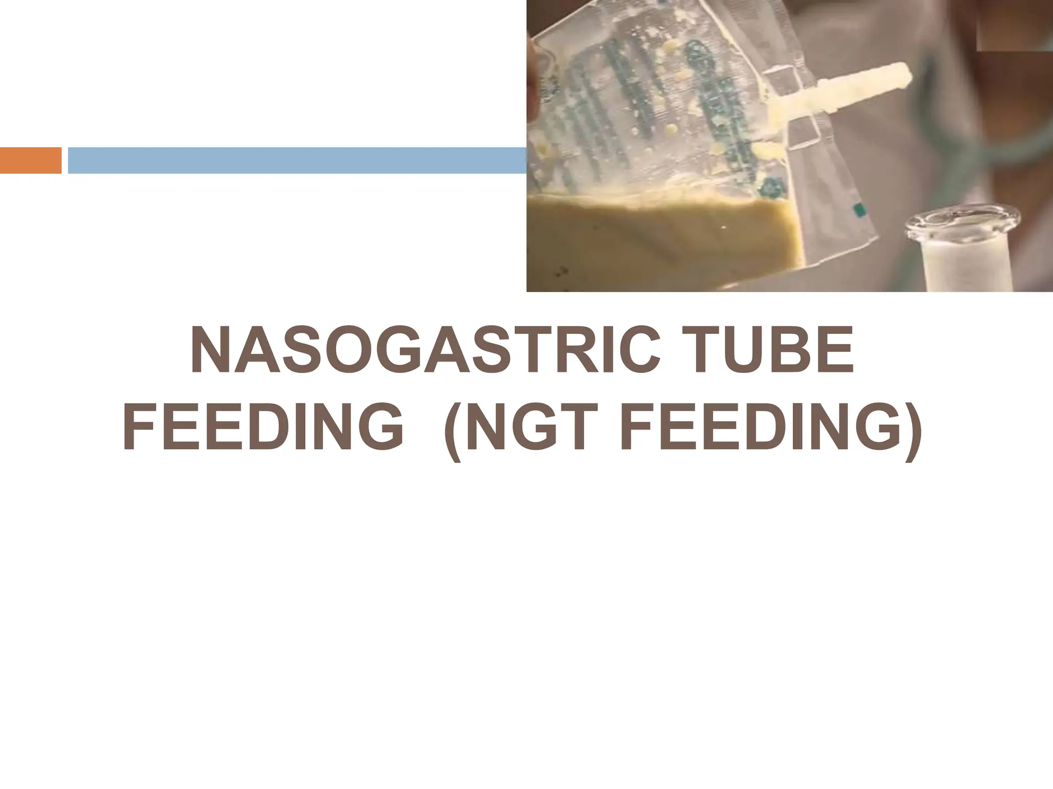 nasogastrictubeinsertionandfeeding-161128104843 (1) (1).pptx
