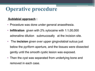 NASOLABIAL CYST.pptx and it’s mangment ,excision | PPTX