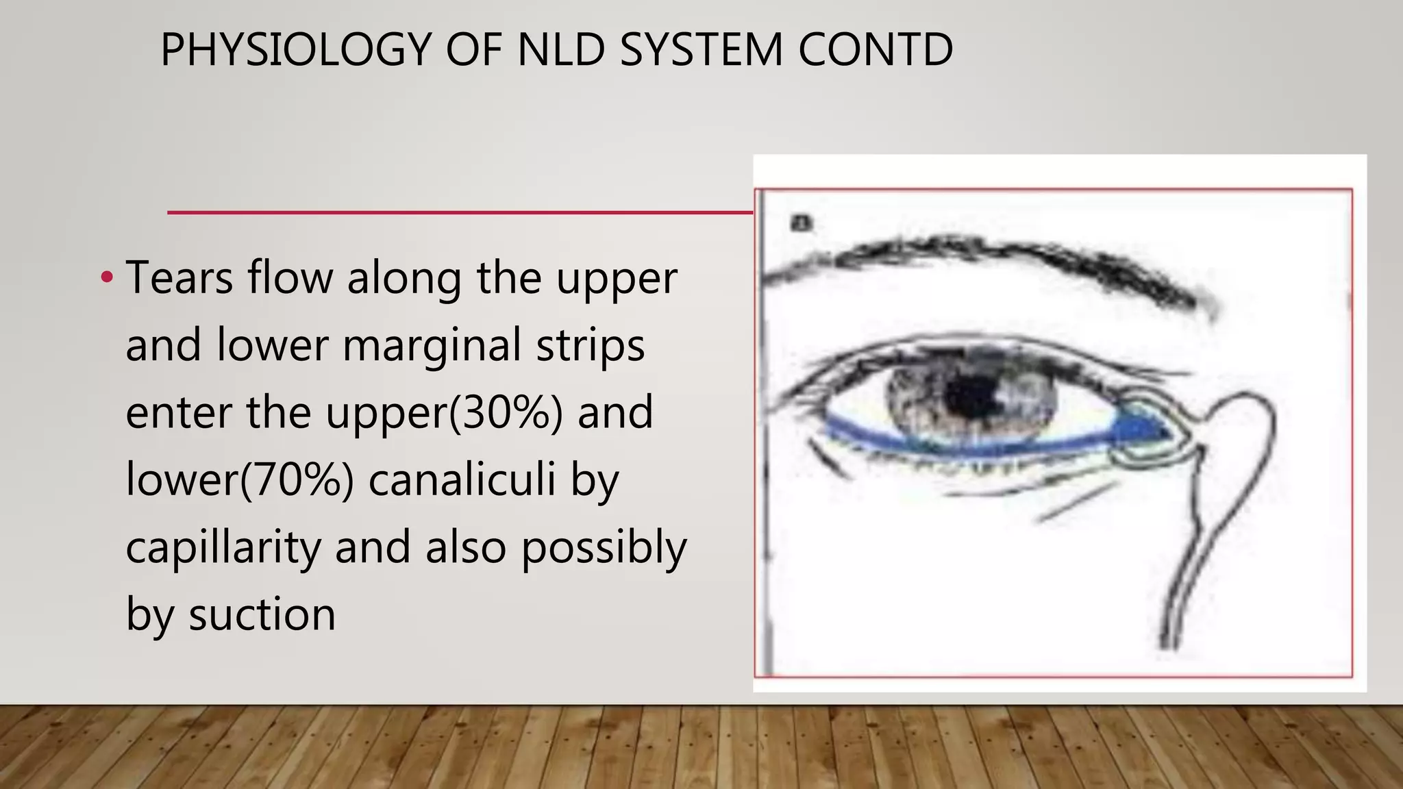 Nasolacrimal duct obstruction | PPTX
