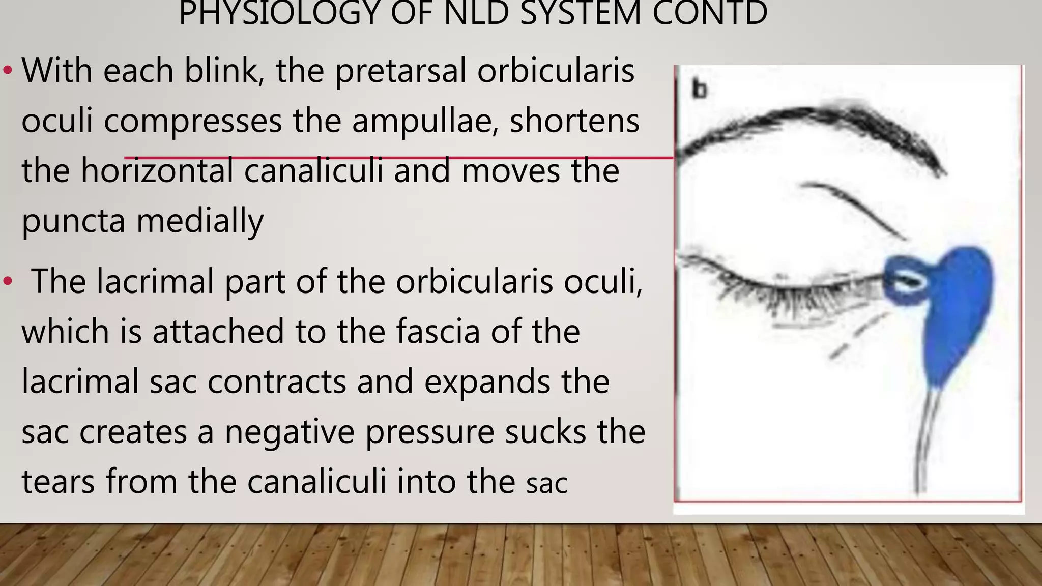 Nasolacrimal duct obstruction | PPTX
