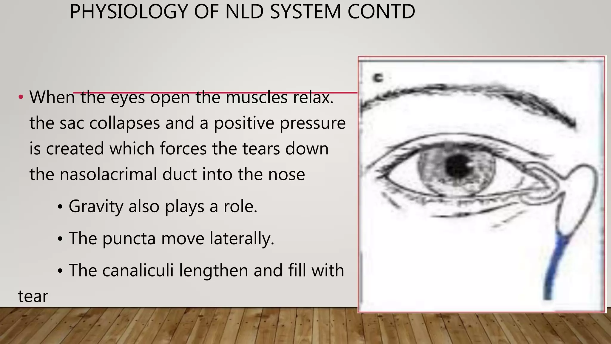 Nasolacrimal duct obstruction | PPTX