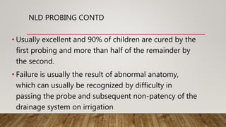 Nasolacrimal duct obstruction | PPTX