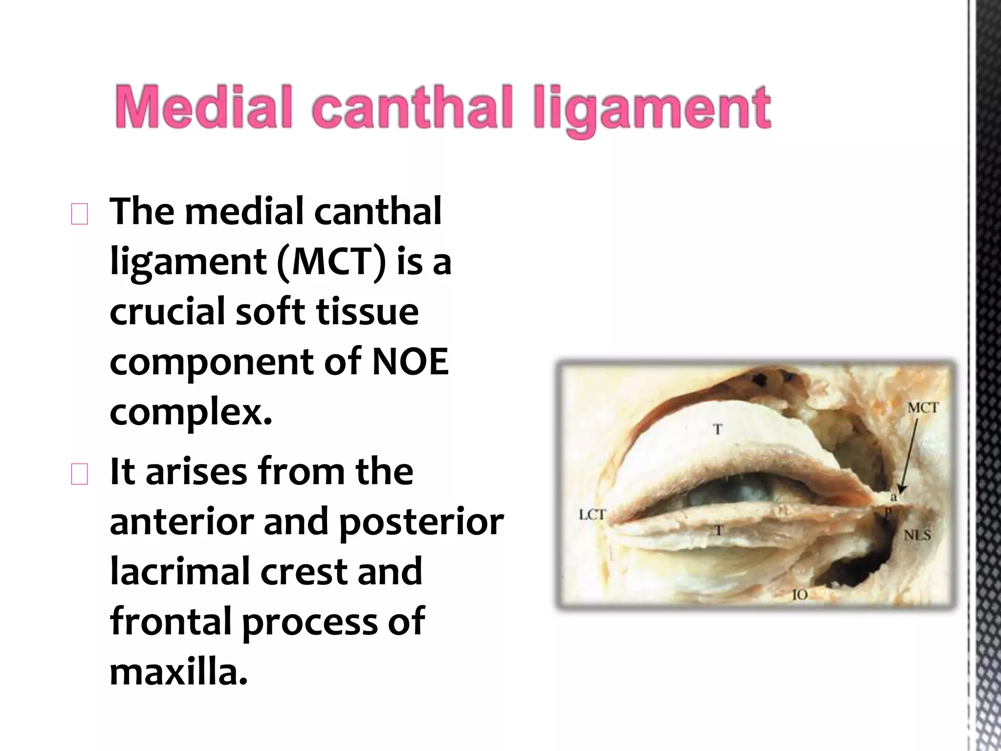 NOE FRACTURE PPT | PPTX