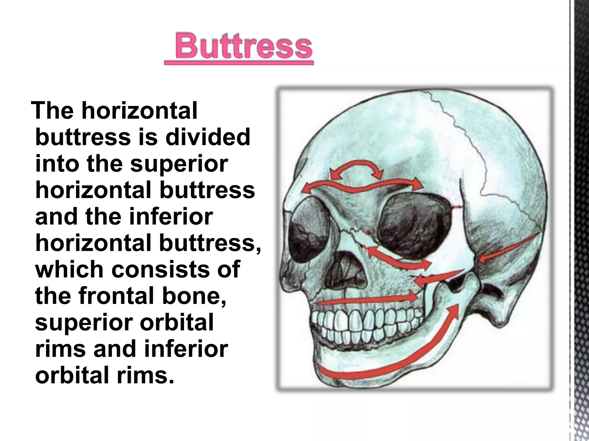 NOE FRACTURE PPT | PPTX
