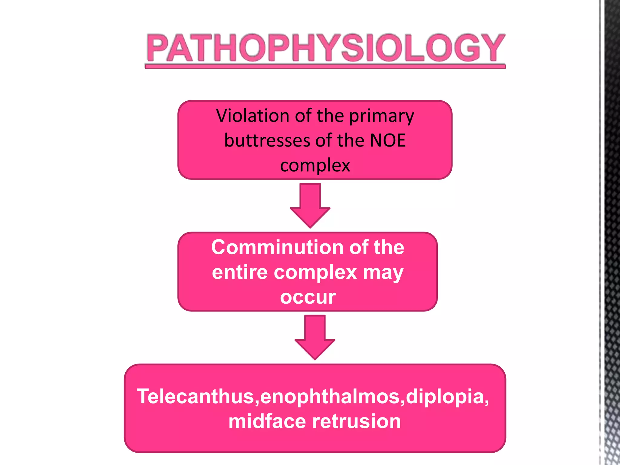 NOE FRACTURE PPT | PPTX