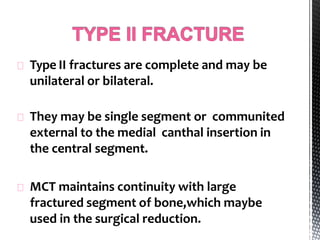 NOE FRACTURE PPT | PPTX