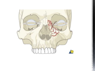 NOE FRACTURE PPT | PPTX