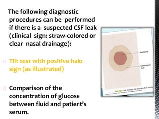 NOE FRACTURE PPT | PPTX