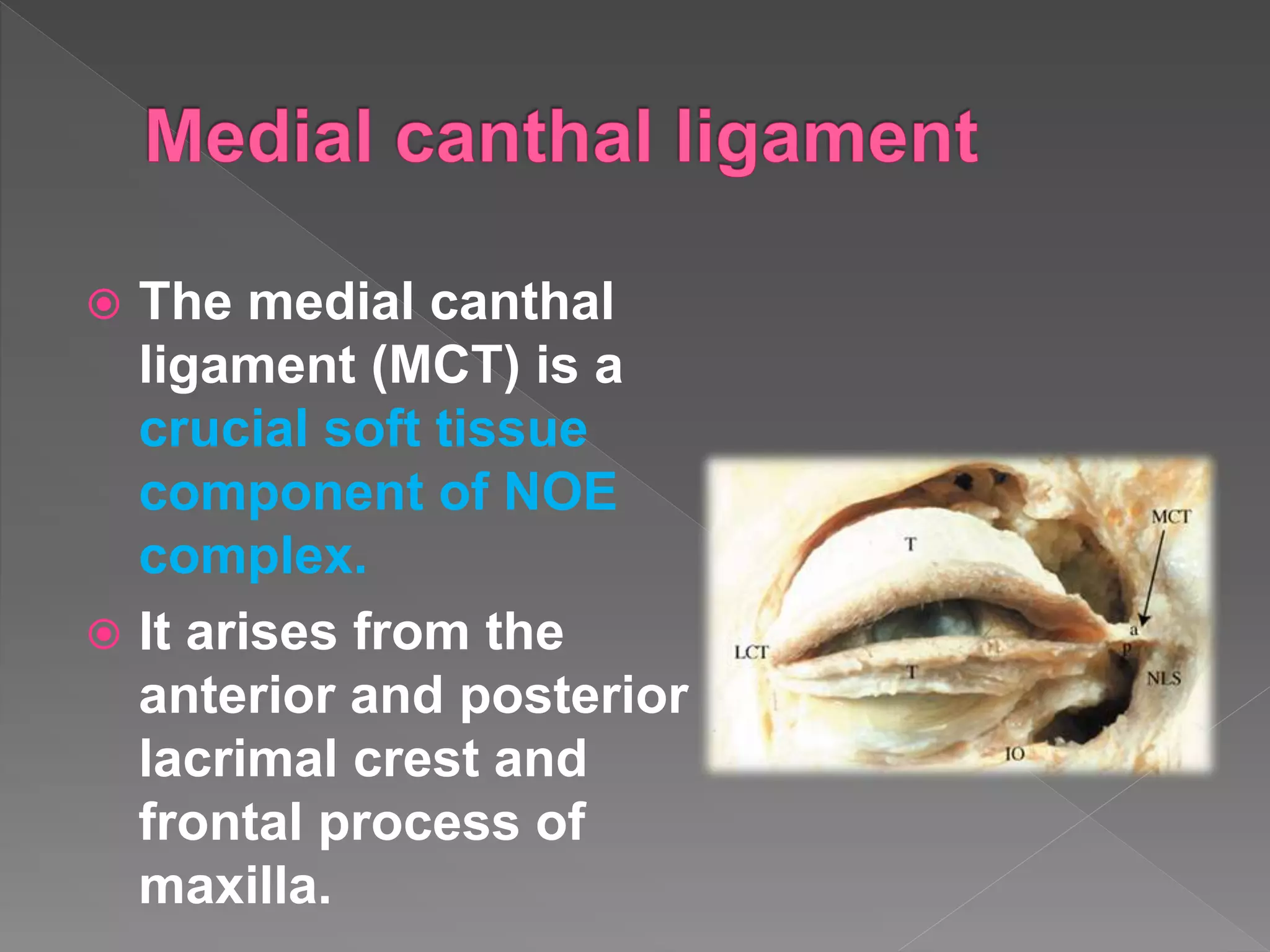 Naso orbito ethmoidal fracture | PPTX