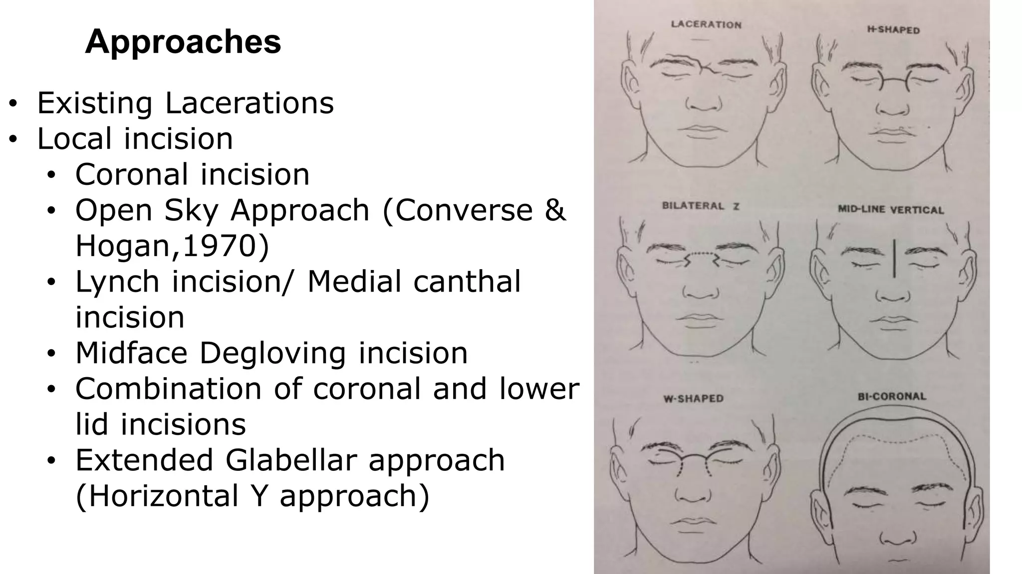 Naso orbito ethmoid (noe) complex fracture | PPTX