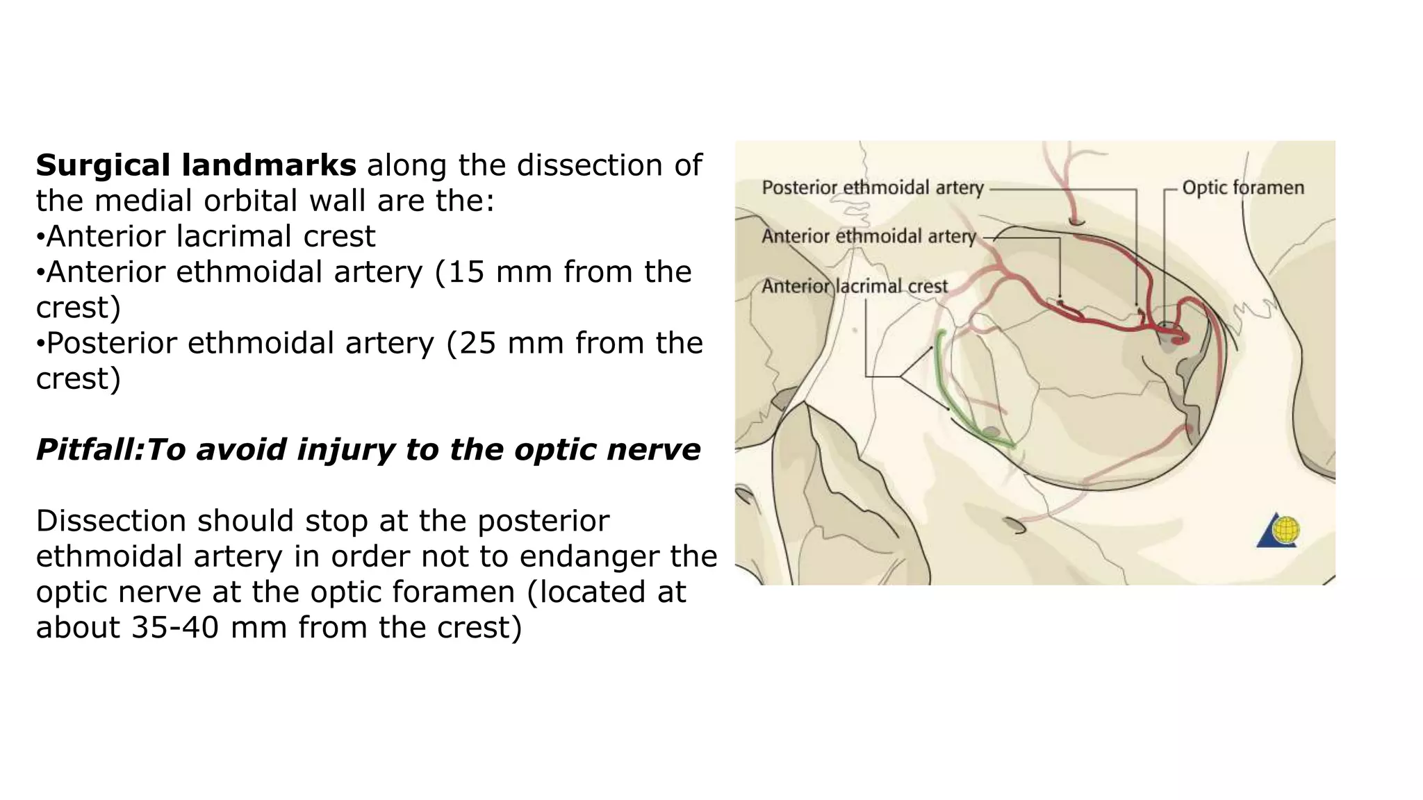 Naso orbito ethmoid (noe) complex fracture | PPTX