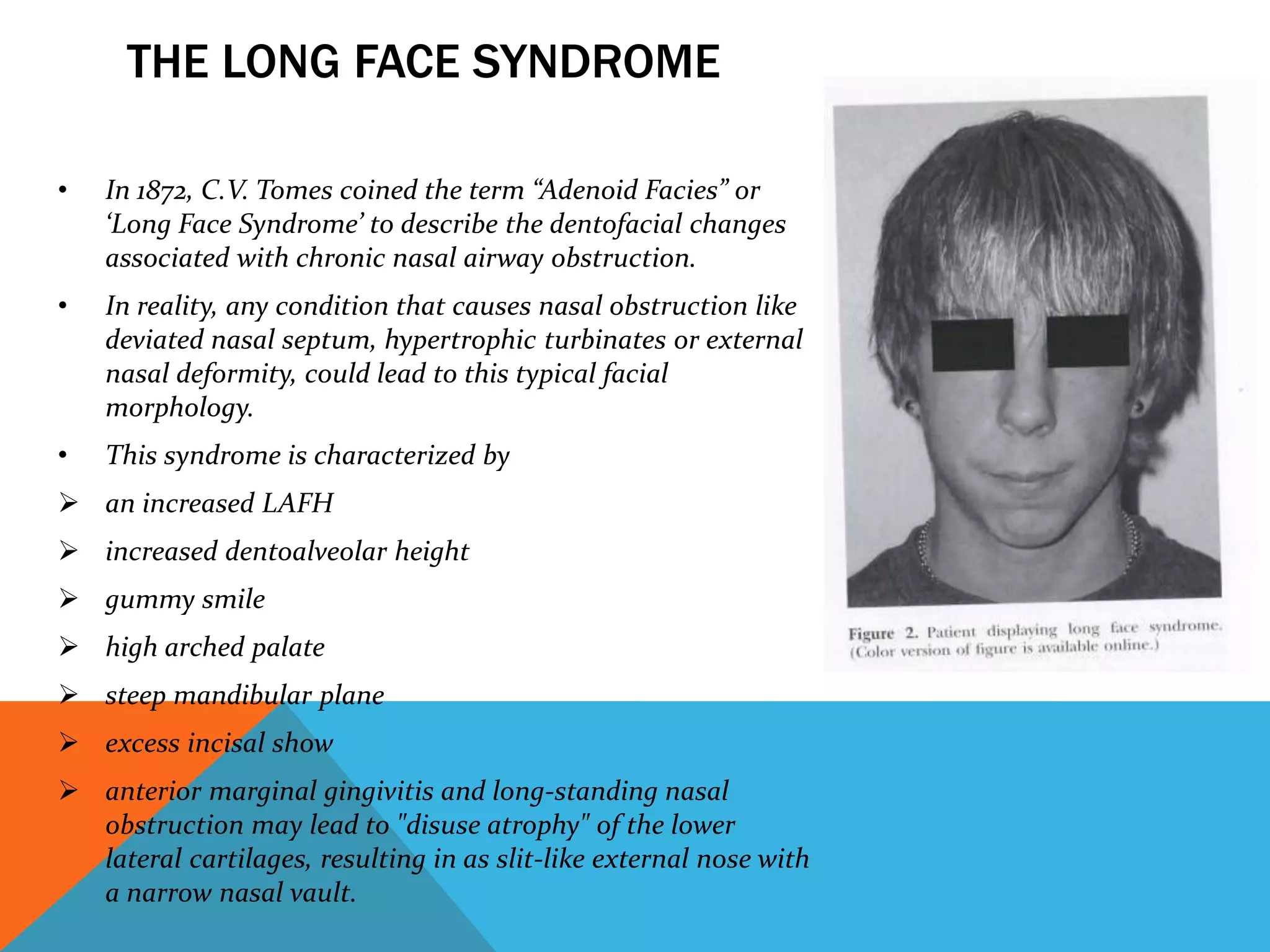 NASOPHARYNGEAL SPACE AND ORTHODONTICS.pptx