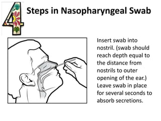 Nasopharyngeal Swab Lecture Health Care Settings | PPTX | Ear, Nose and ...