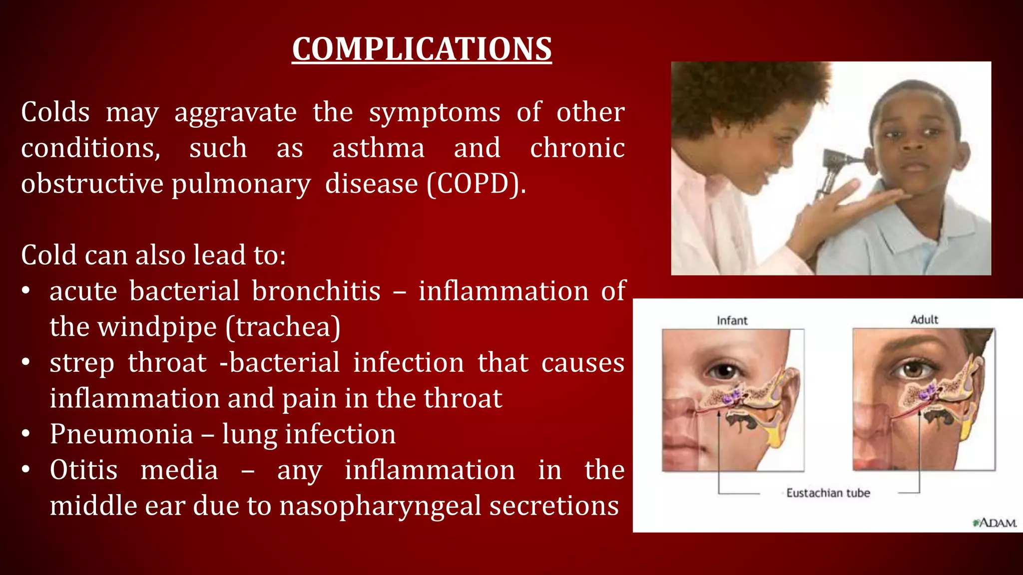 Nasopharyngitis | PPTX